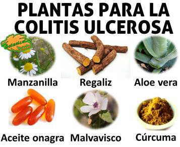 Tratamiento de COLITIS ULCEROSA: Plantas MEDICINALES para aliviarla